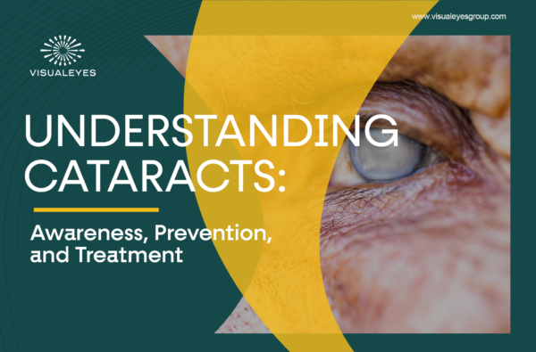 Understanding Cataracts: Awareness, Prevention, and Treatment ...